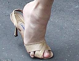 WHY DO WOMEN WEAR SHOES THAT DON'T FIT? - Page 2 - Blogs & Forums